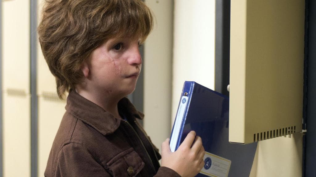Sindrome De Treacher Collins, Wonder Auggie Día Internacional Del