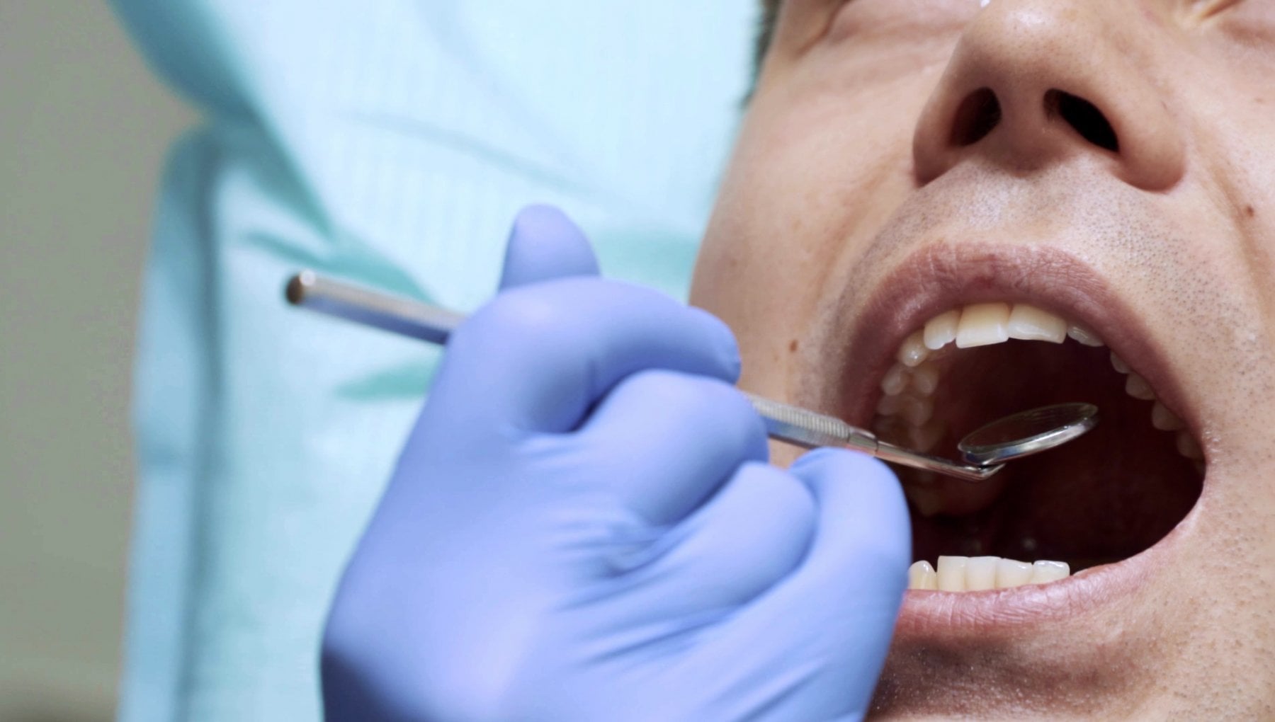 Oral cancer, a simple test can save your life - Breaking Latest News