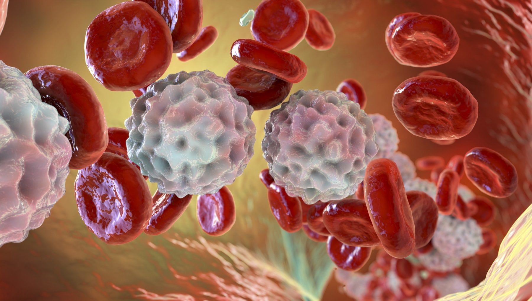 Leukemia Types Subtypes And Therapies Breaking Latest News Leukemia Types Subtypes And Therapies Breaking Latest News