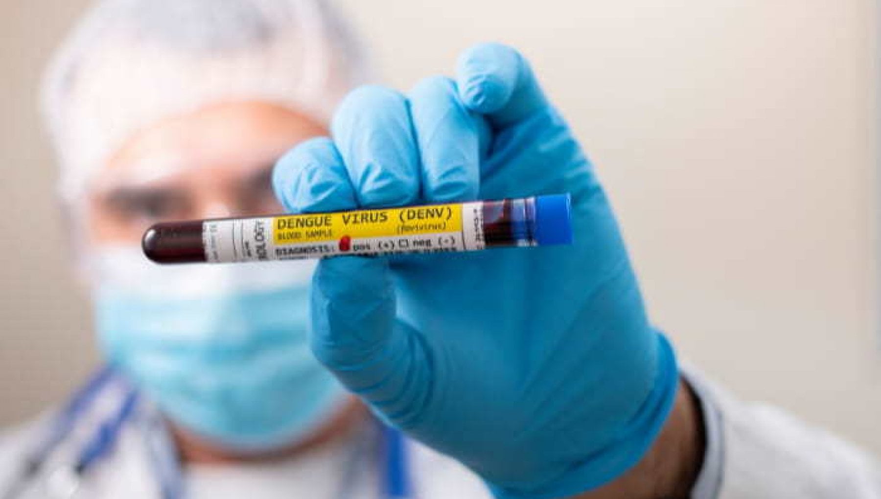 Robot anti-zanzare contro l'attacco del virus dengue - la Repubblica