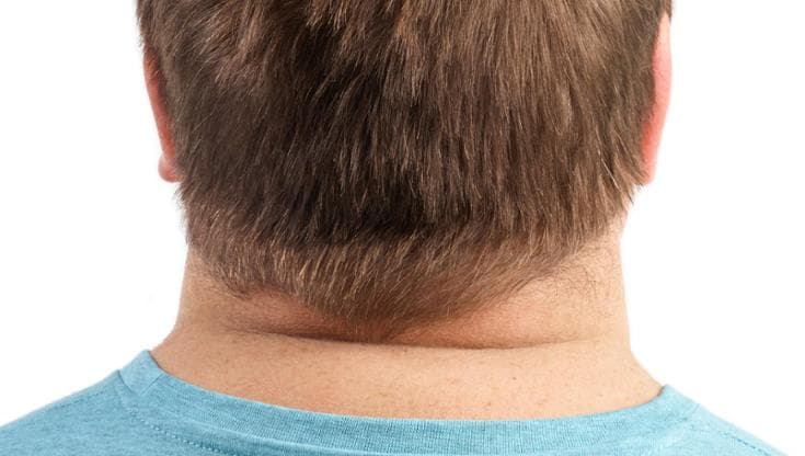 Non solo girovita, anche il collo largo può essere un rischio per la ...