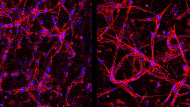 Retina, così le staminali possono riparare i vasi sanguigni - la Repubblica