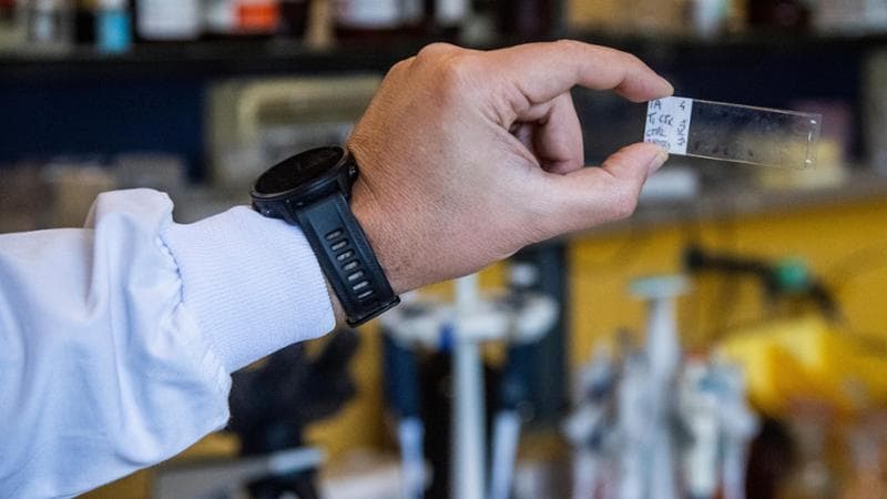 Diabete e cure per l’obesità, la “fabbrica di startup” del Salento ...