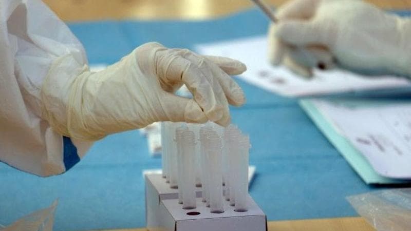 Campania, Federlab: “Tolti 15 milioni alla specialistica” - la Repubblica