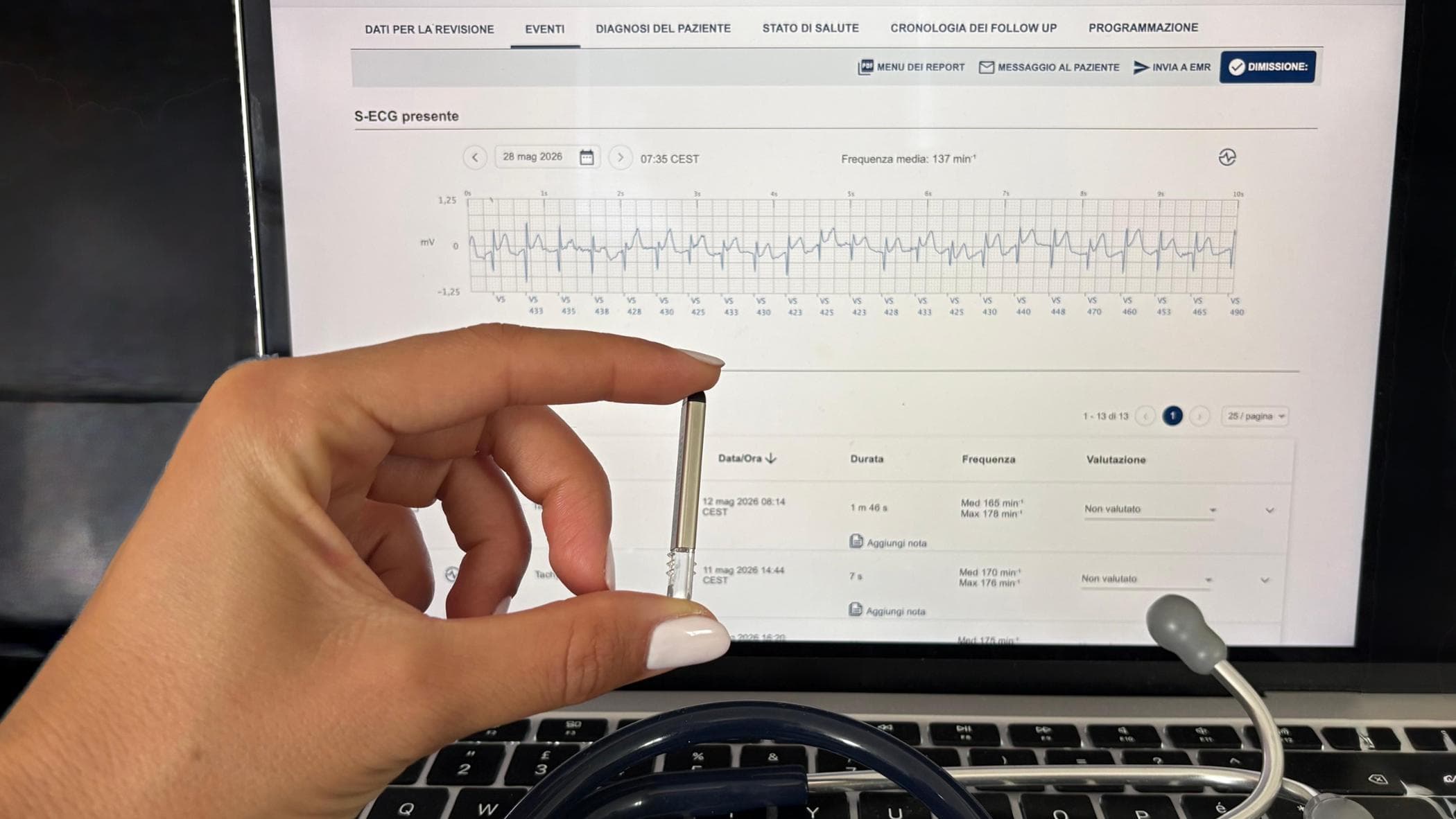 Santobono: ecco il Loop Recorder, salvavita che controlla a distanza i ...