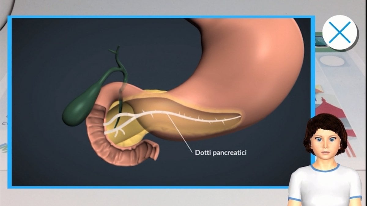 Tumore del pancreas, una app aiuta il paziente - la Repubblica