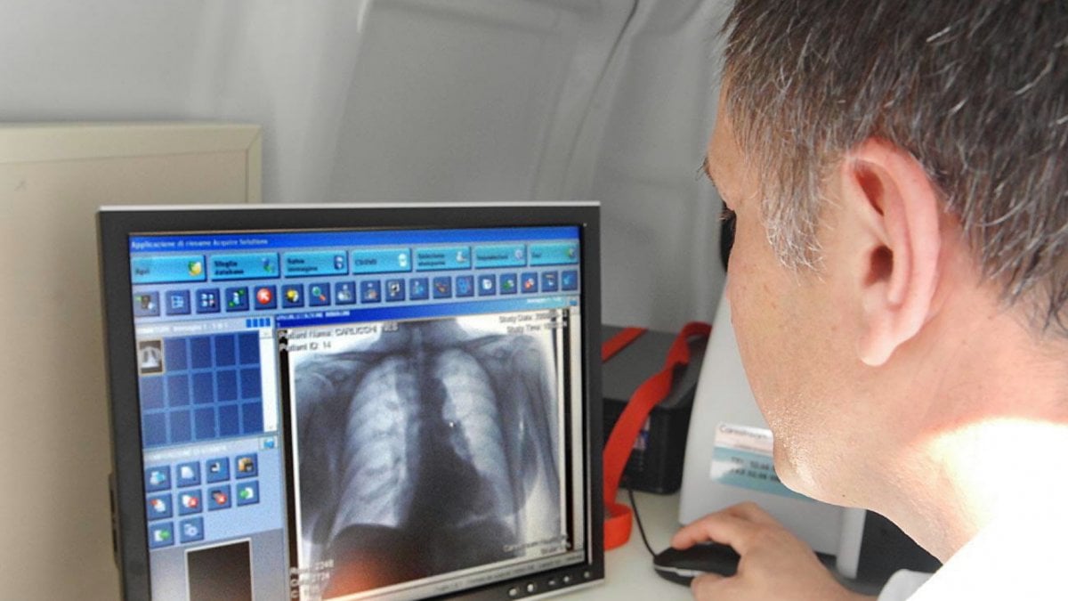 Coronavirus, il 30% dei guariti avrà problemi respiratori cronici - la ...