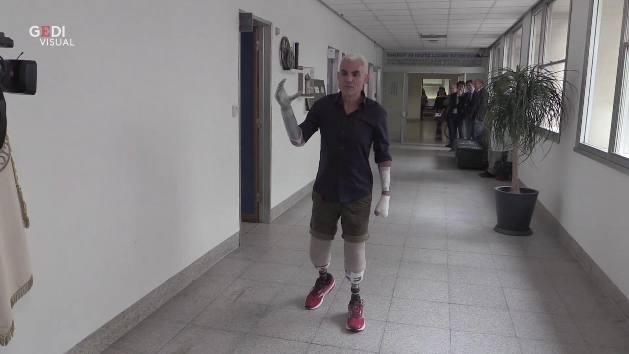 Roberto Zanda l'ultramaratoneta con una mano bionica e protesi ai piedi ...